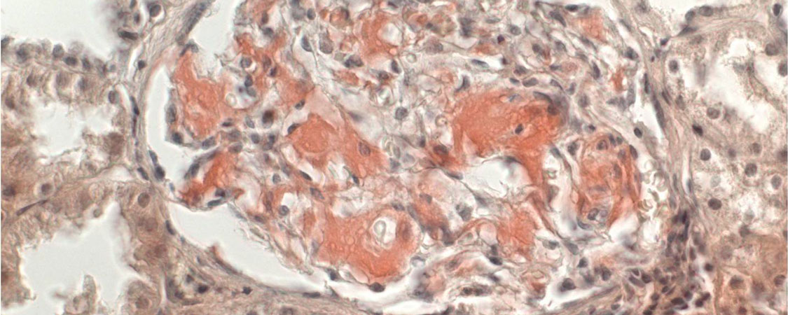 Der Lauf Ihrer Probe